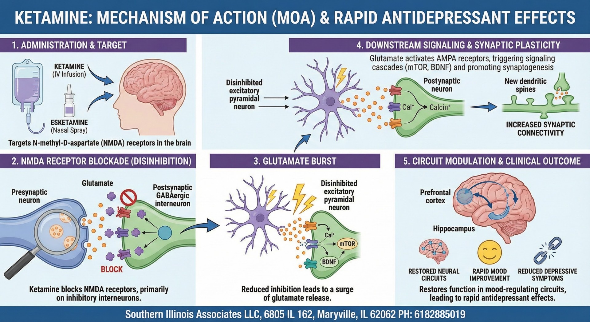 Ketamine Mechanism of Action - How Ketamine Works | Southern Illinois ...